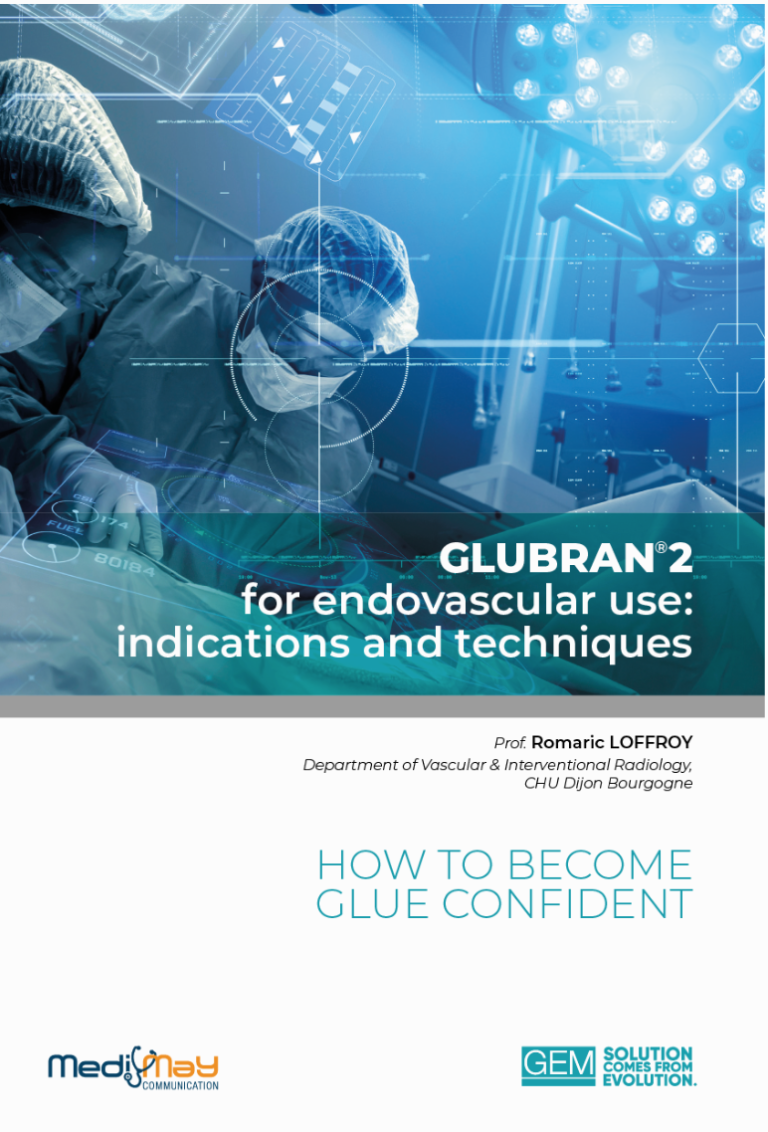 Glubran2 for endovascular use: indications and techniques – GEM Italy
