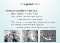Glubran2 for endovascular use: indications and techniques - GEM Italy
