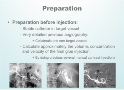 Glubran2 for endovascular use: indications and techniques - GEM Italy